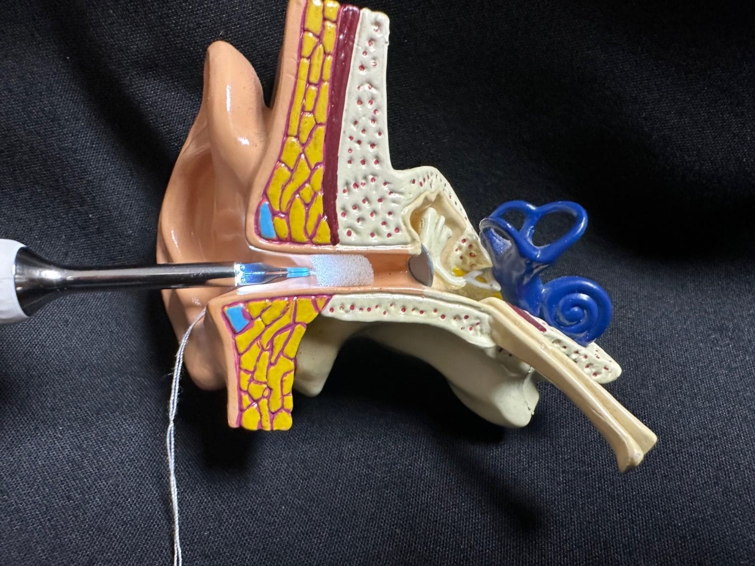 EAR/BeBird Note 5 PRO Digital Otoscope Kit - EAR Customized Hearing ...