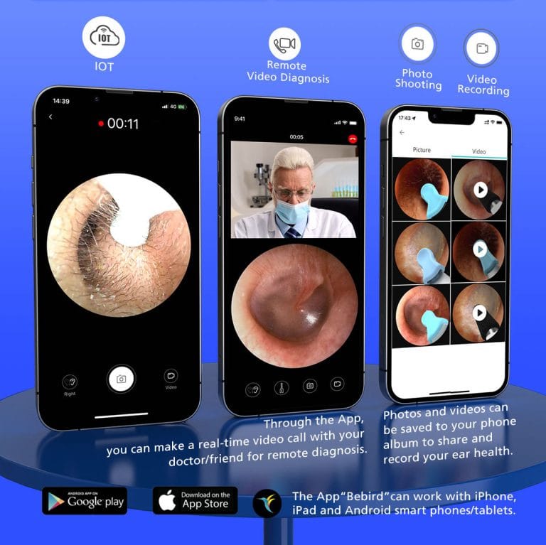 EAR/BeBird Note 5 PRO Digital Otoscope Kit - EAR Customized Hearing ...