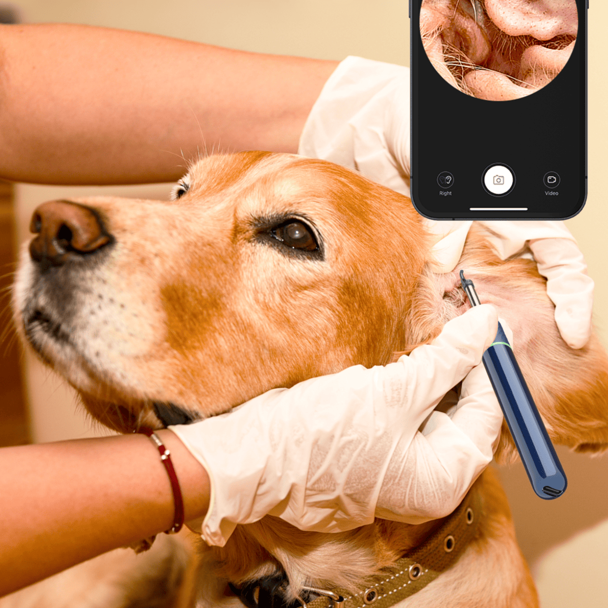 Digital Otoscopes - Video Earwax Removal Tool - Electronic Otoscope ...